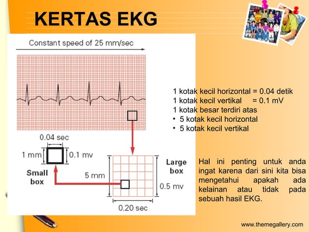 Presentasi ekg rs agung | PPT | Heart and Cardiovascular Diseases | Diseases and Conditions