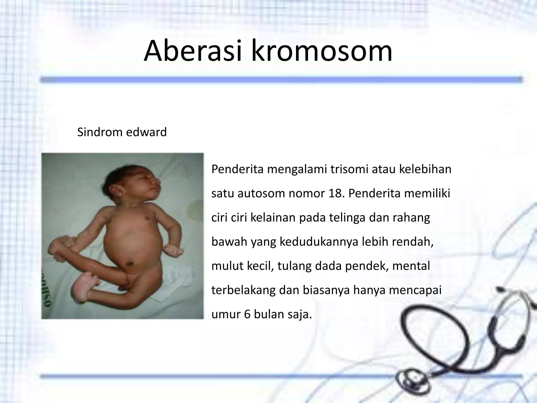 Presentasi gambar kelainan genetik | PPTX