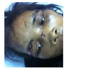 Presentasi ham | ODP