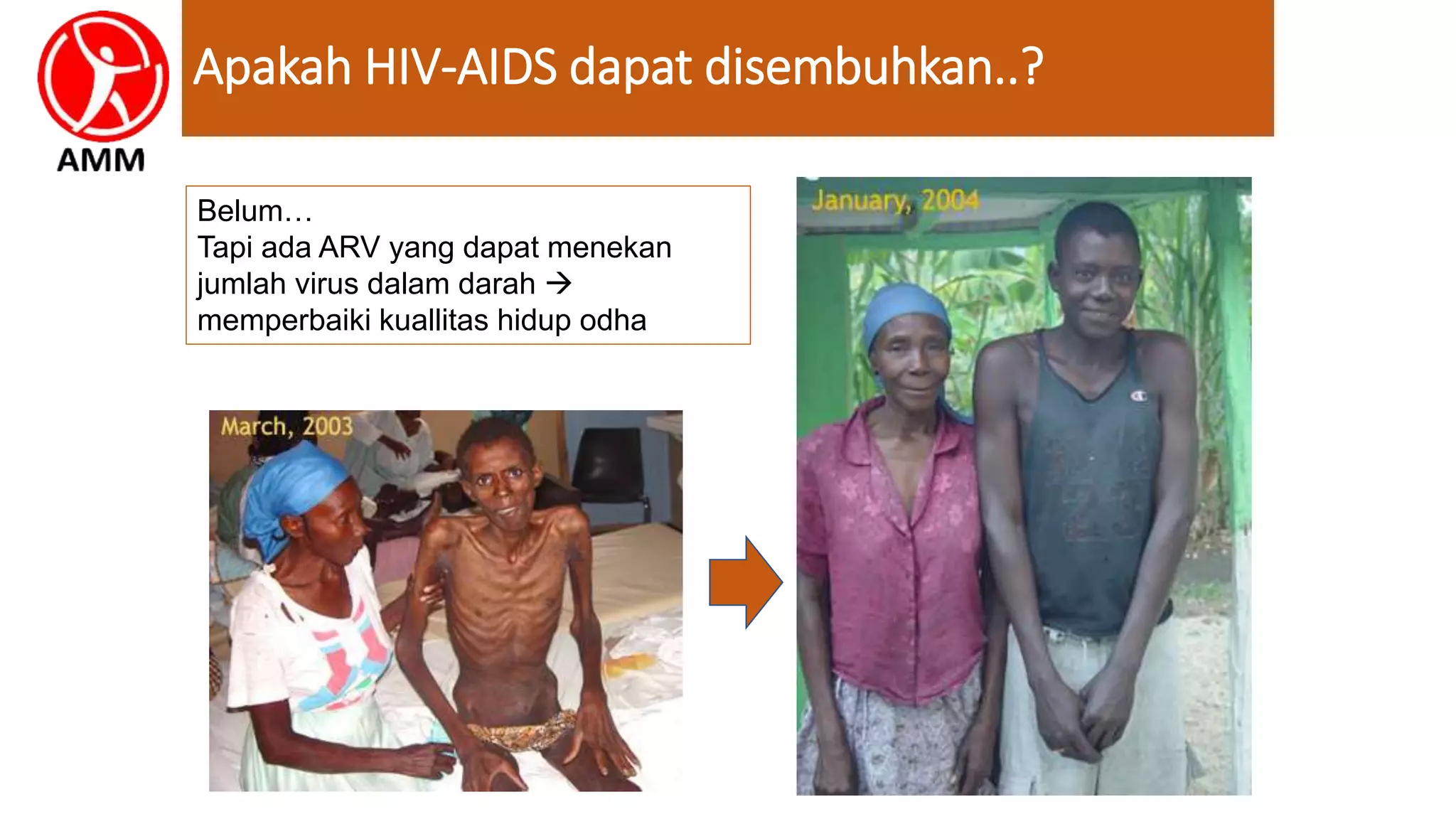 Presentasi HIV MTS fix.pptx
