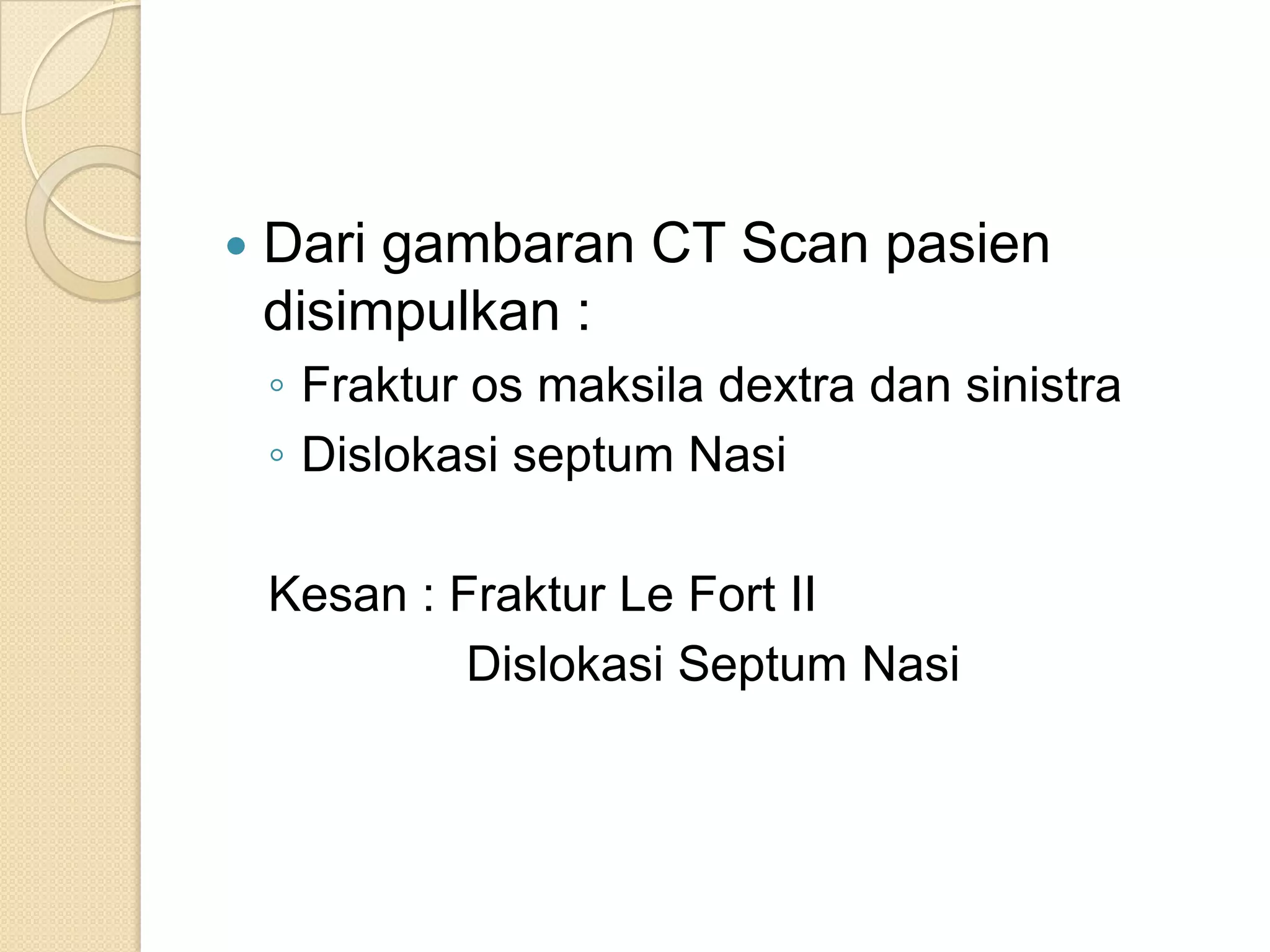 Presentasi jaka le fort ii | PPTX