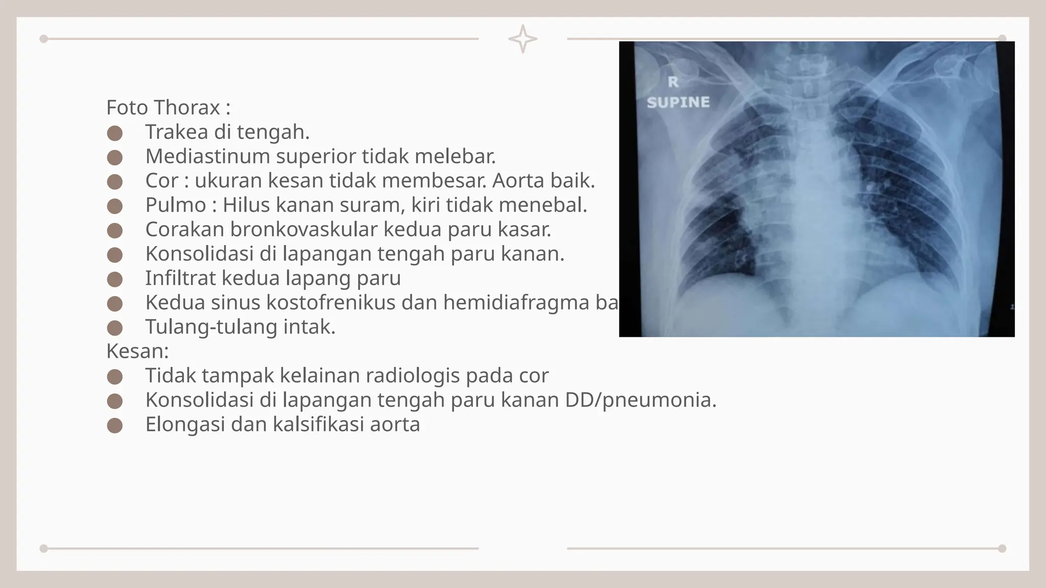 Presentasi Kasus Geriatri lansia ppt.pptx