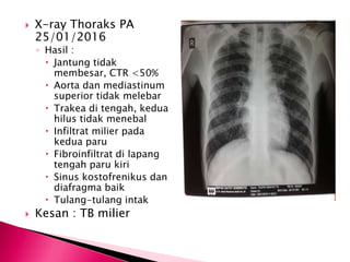 Case Presentation Co infection Miliary Tuberculosis and HIV/AIIDS | PPTX
