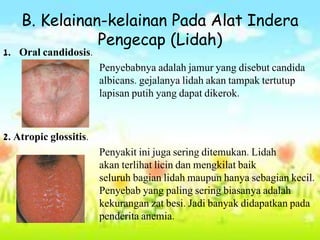 Presentasi kelainan kelainan pada alat indera | PPTX