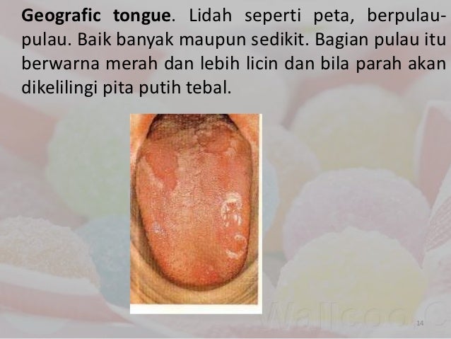 Alat Indra : Kulit dan Lidah