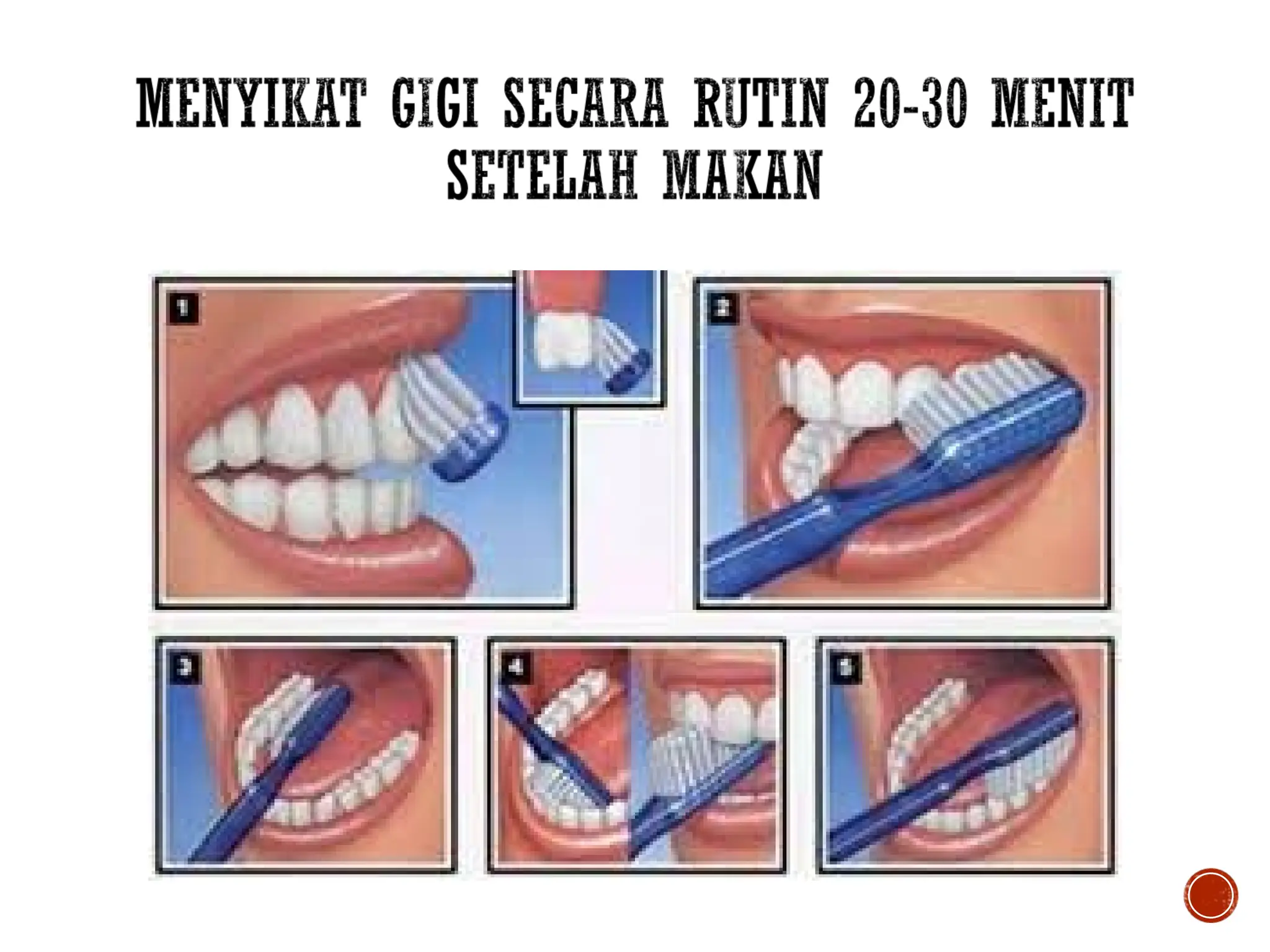 presentasi kesgilut bagi Prolanis DM drg Ridwan PKM Kalibakung.ppt