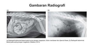 Presentasi Megakolon.pptx
