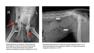 Presentasi Megakolon.pptx