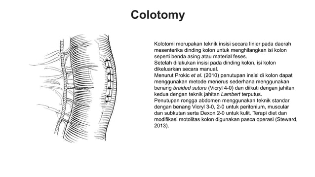 Presentasi Megakolon.pptx