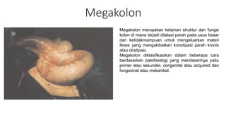 Presentasi Megakolon.pptx