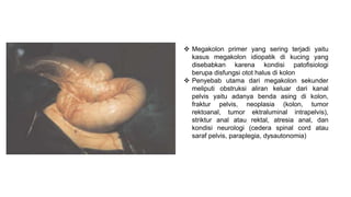 Presentasi Megakolon.pptx