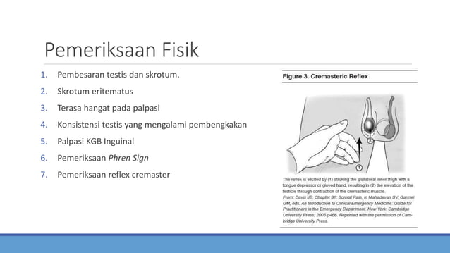 Orkitis (Orchitis) - Presentasi Kasus
