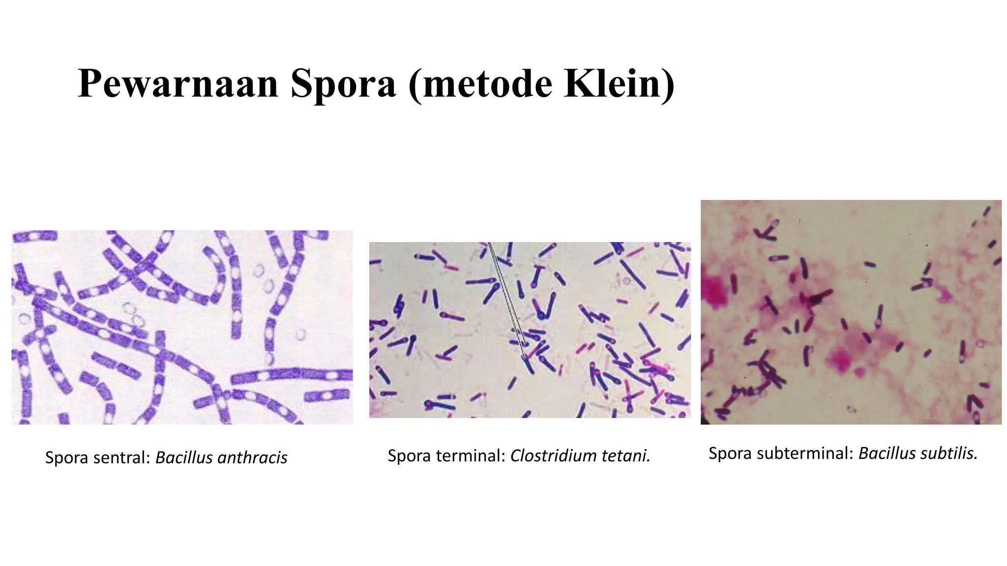 presentasi pewarnaan gram.pdffffffffffff | PDF