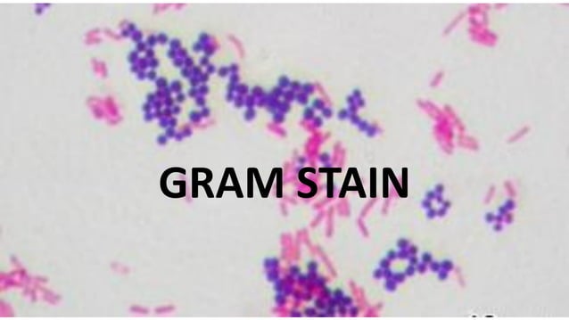 presentasi pewarnaan gram.pdffffffffffff | PDF