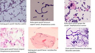 presentasi pewarnaan gram.pdffffffffffff | PDF