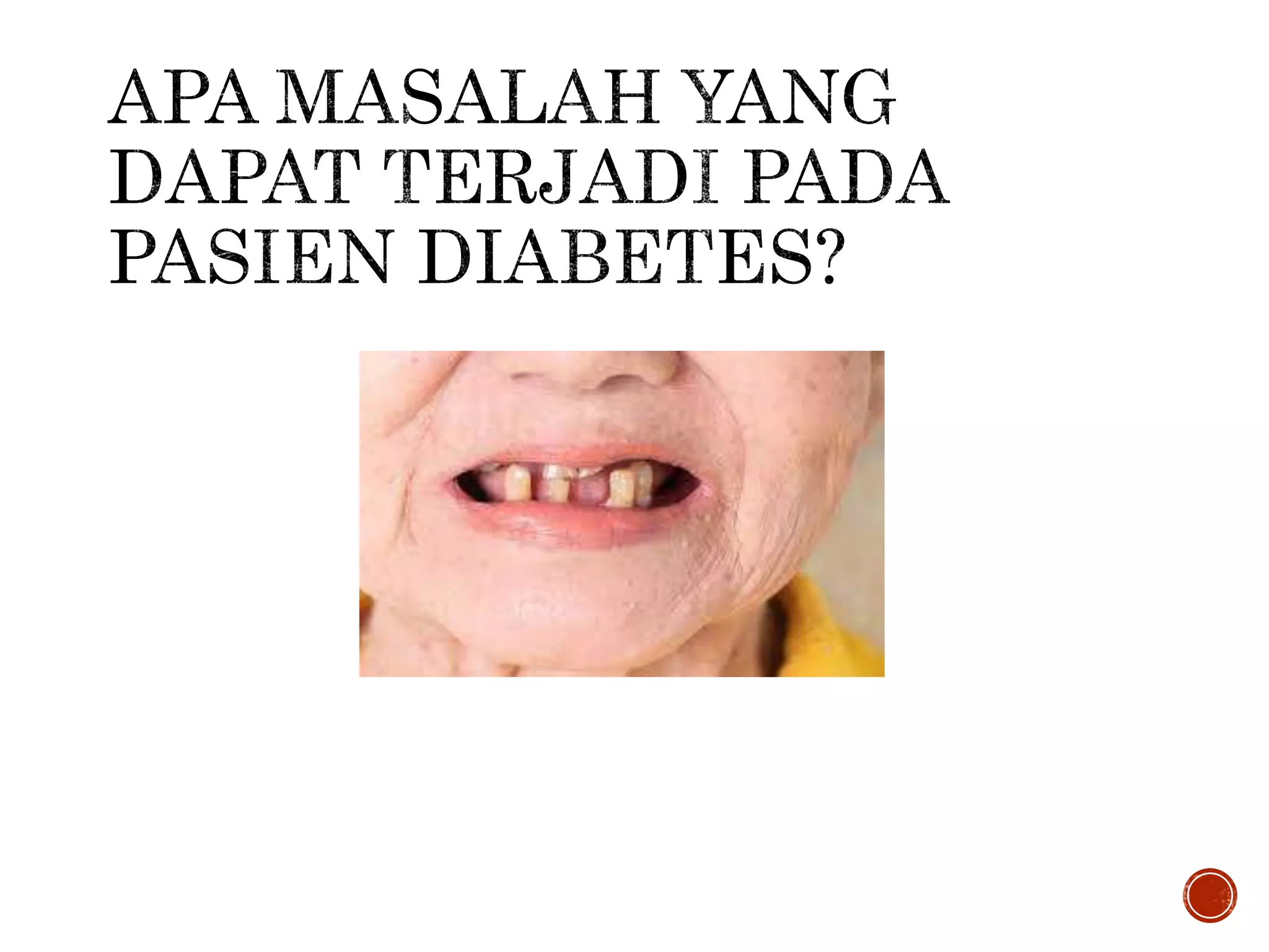 presentasi prolanis.ppt