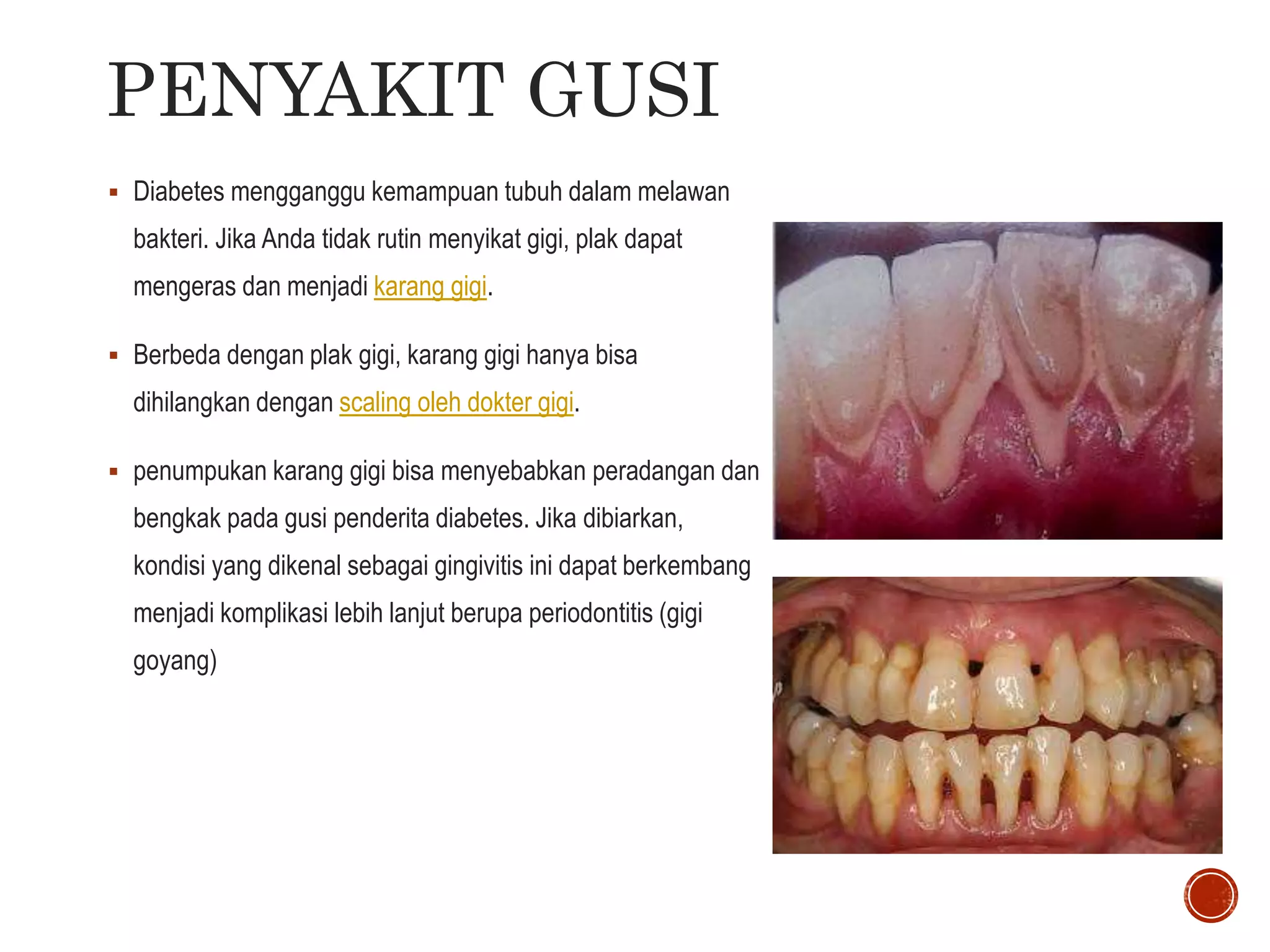 presentasi prolanis.ppt