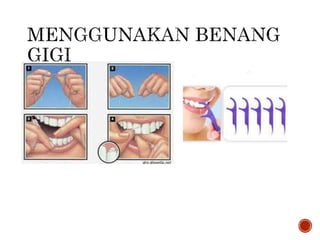 presentasi prolanis.ppt