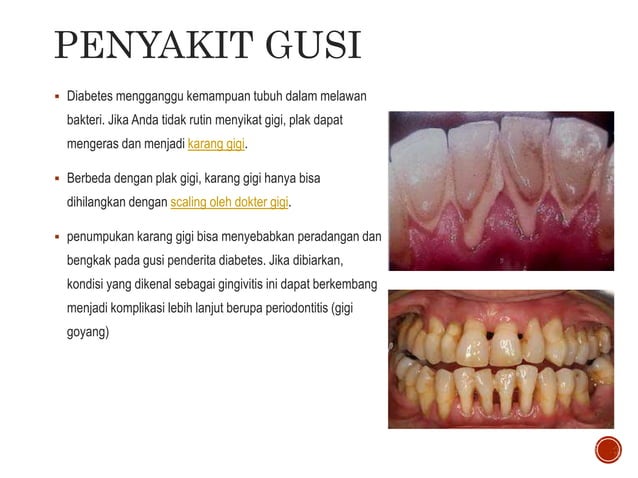 presentasi prolanis.ppt