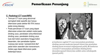 Sari Pustaka Diagnosis dan tatalaksana kolitis eosinofilik | PPT