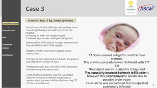 literature review the accuracy of ett size estimation with children ...