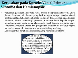 Presentasi sistem visual | PPTX