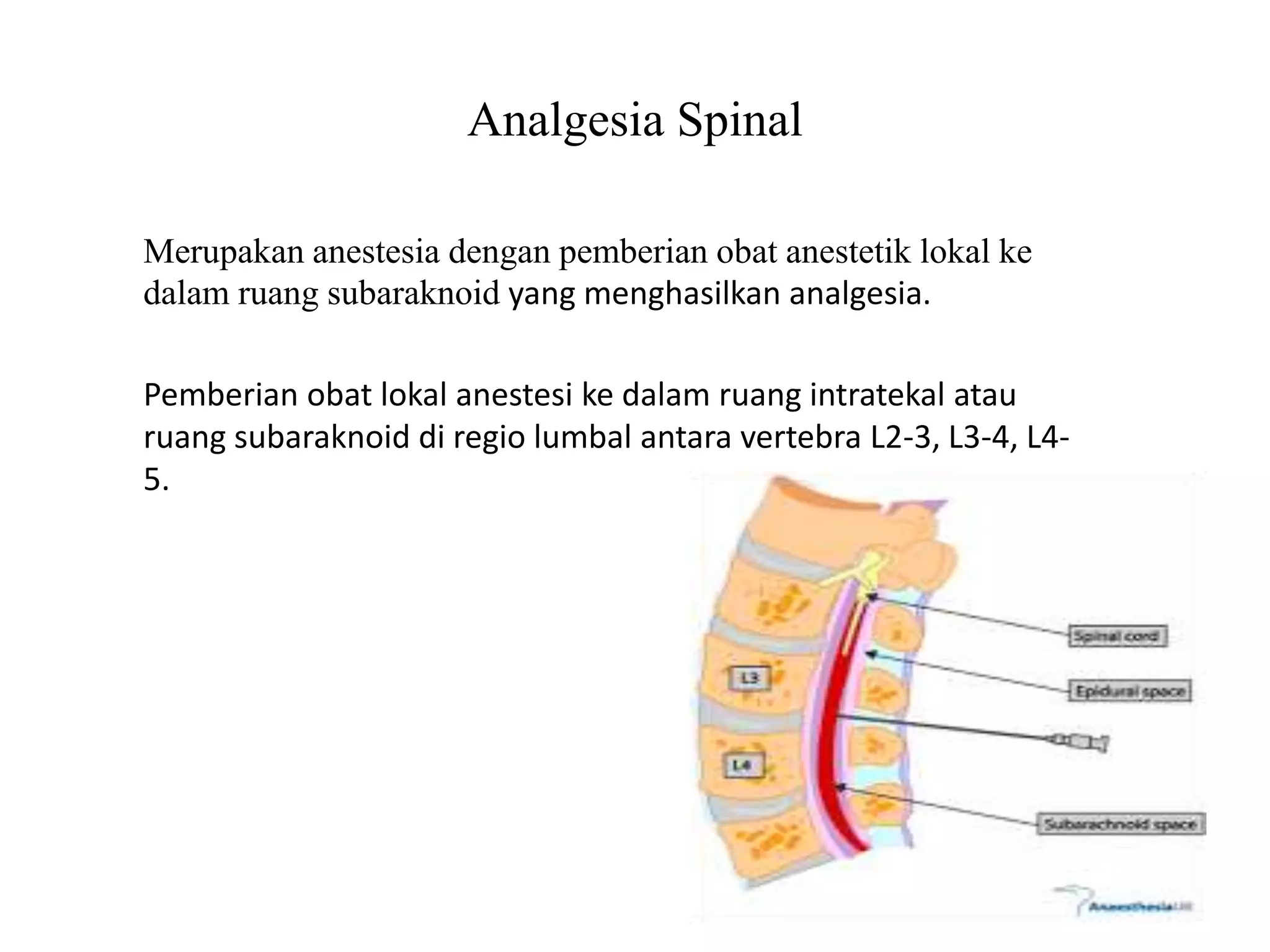 Presentasi spinal anestesi | PPTX