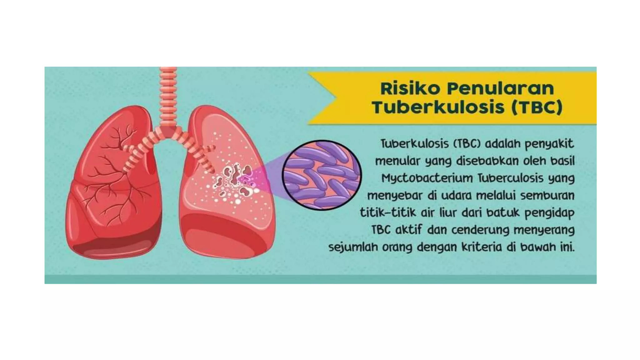 presentasi TB PARU.pptx