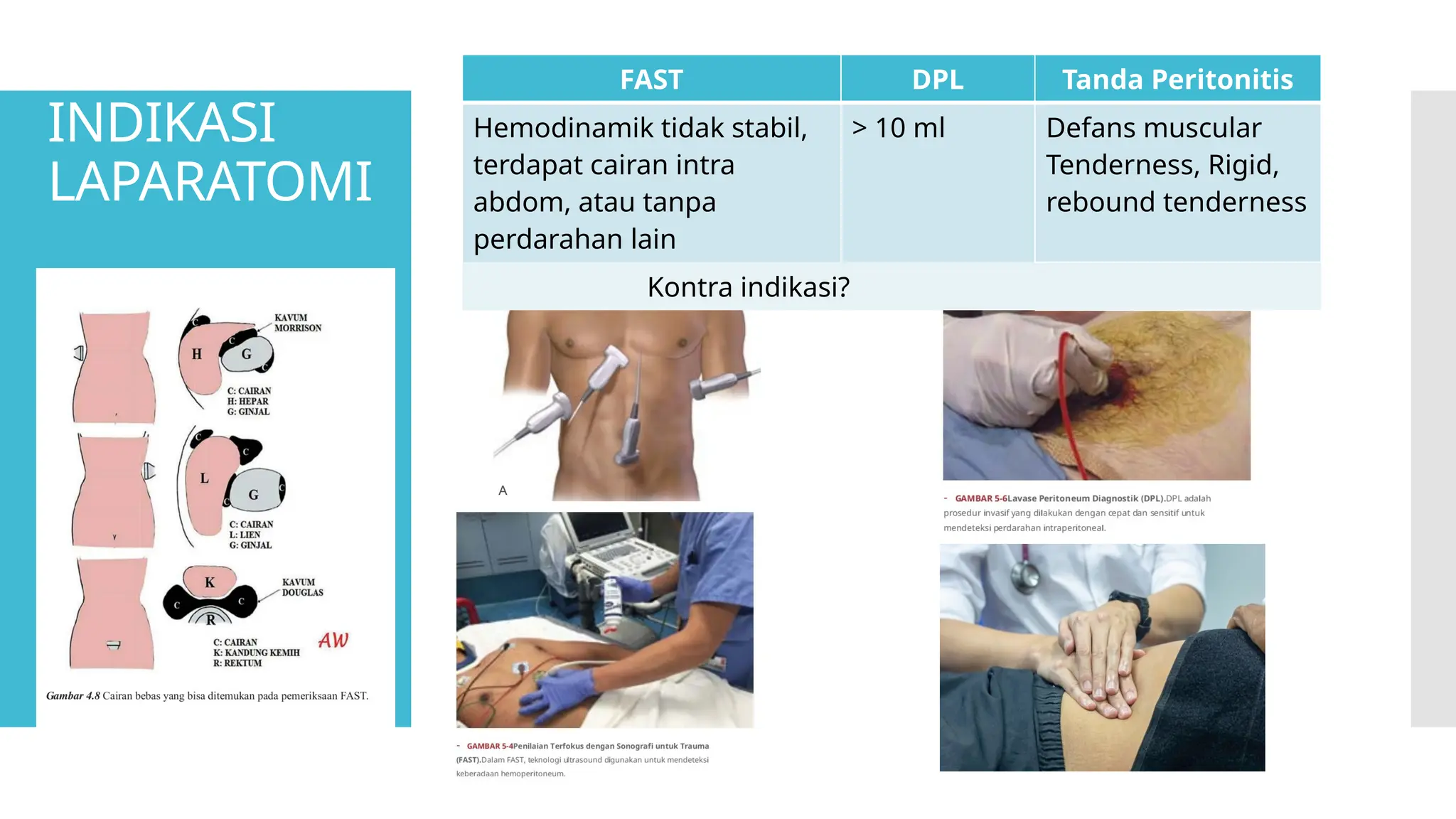 presentasi trauma tumpul pengertian, algoritma | PPTX