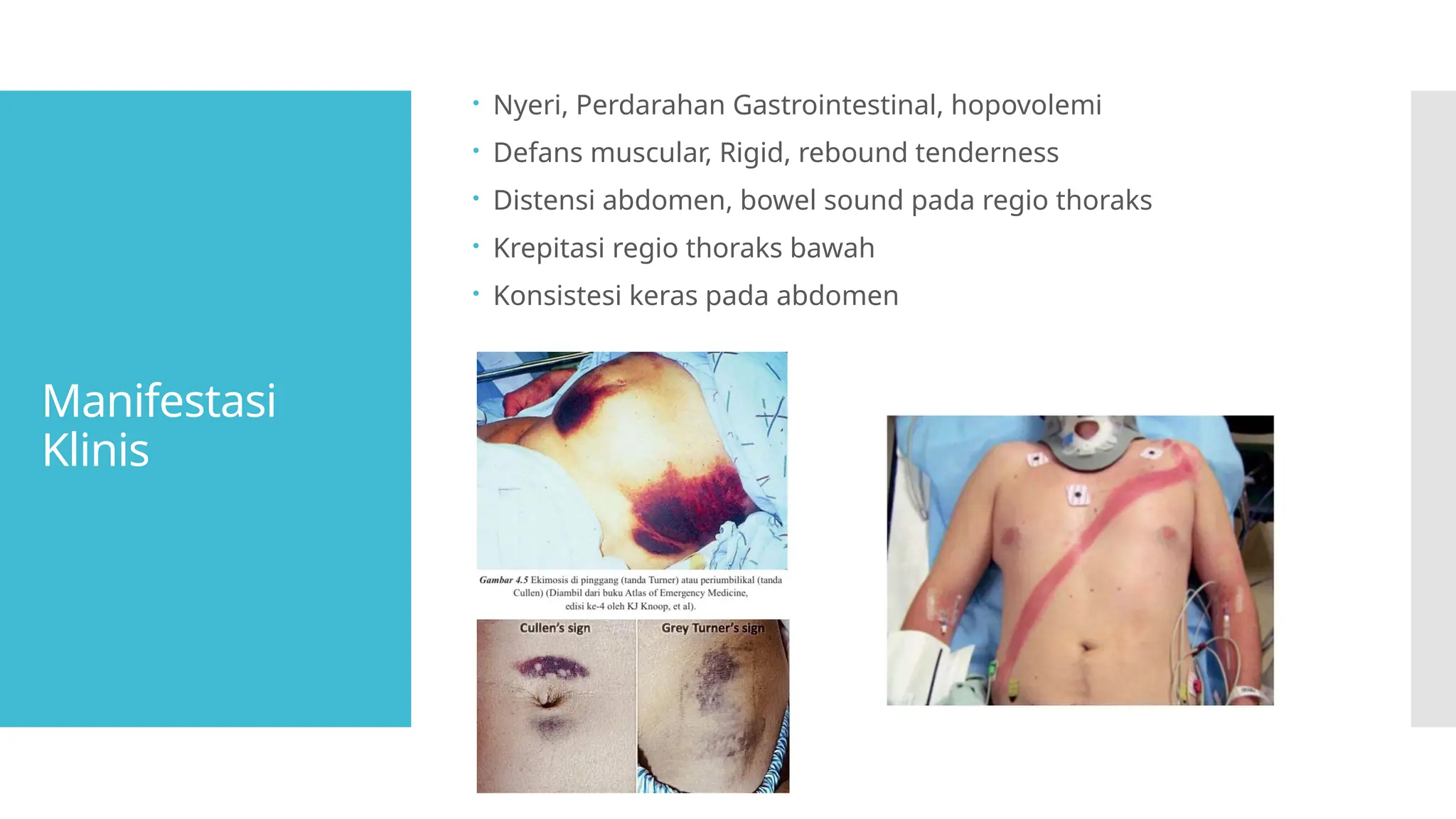 presentasi trauma tumpul pengertian, algoritma | PPTX