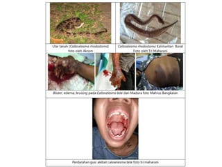 tatalaksana gigitan ular (snake bite) dan follow up | PPT
