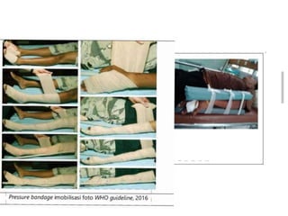 tatalaksana gigitan ular (snake bite) dan follow up | PPT