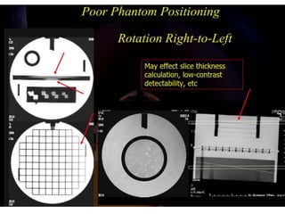 MRI Quality Control ACR Phantom PRO MRI | PPTX