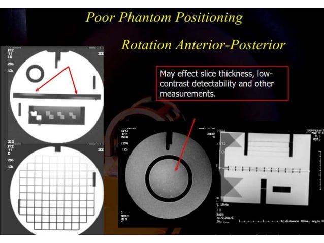 MRI Quality Control ACR Phantom PRO MRI | PPTX