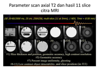 MRI Quality Control ACR Phantom PRO MRI | PPTX