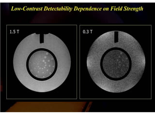 MRI Quality Control ACR Phantom PRO MRI | PPTX