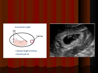 PENGENALAN USG KEBIDANAN | PPT