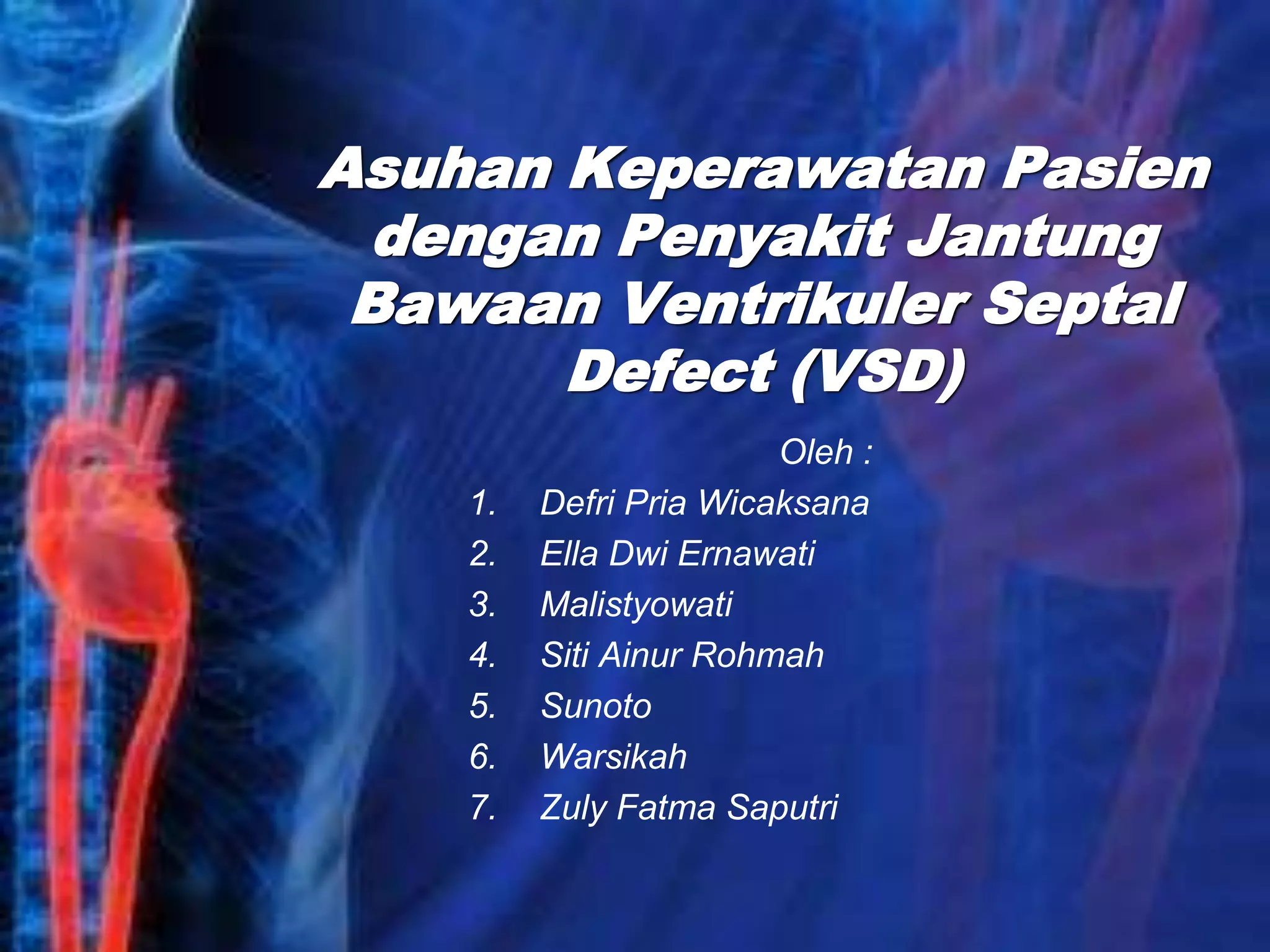 Presentasi vsd (Ventrikel septal defect) | PPTX