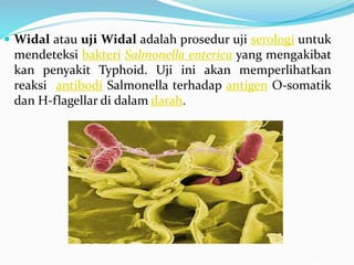 Presentasi widal.ppt