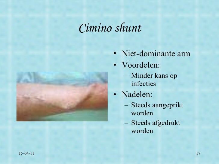 Presentation about Kidneys