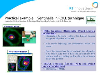 R2Innovations / OncoVision : Sentinella - your new eyes | PPT
