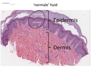 Presentatie pathologie huid_hpv_nmdl-lcpl | PPT
