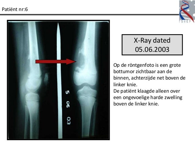 Banerji Protocols - Botkanker 2