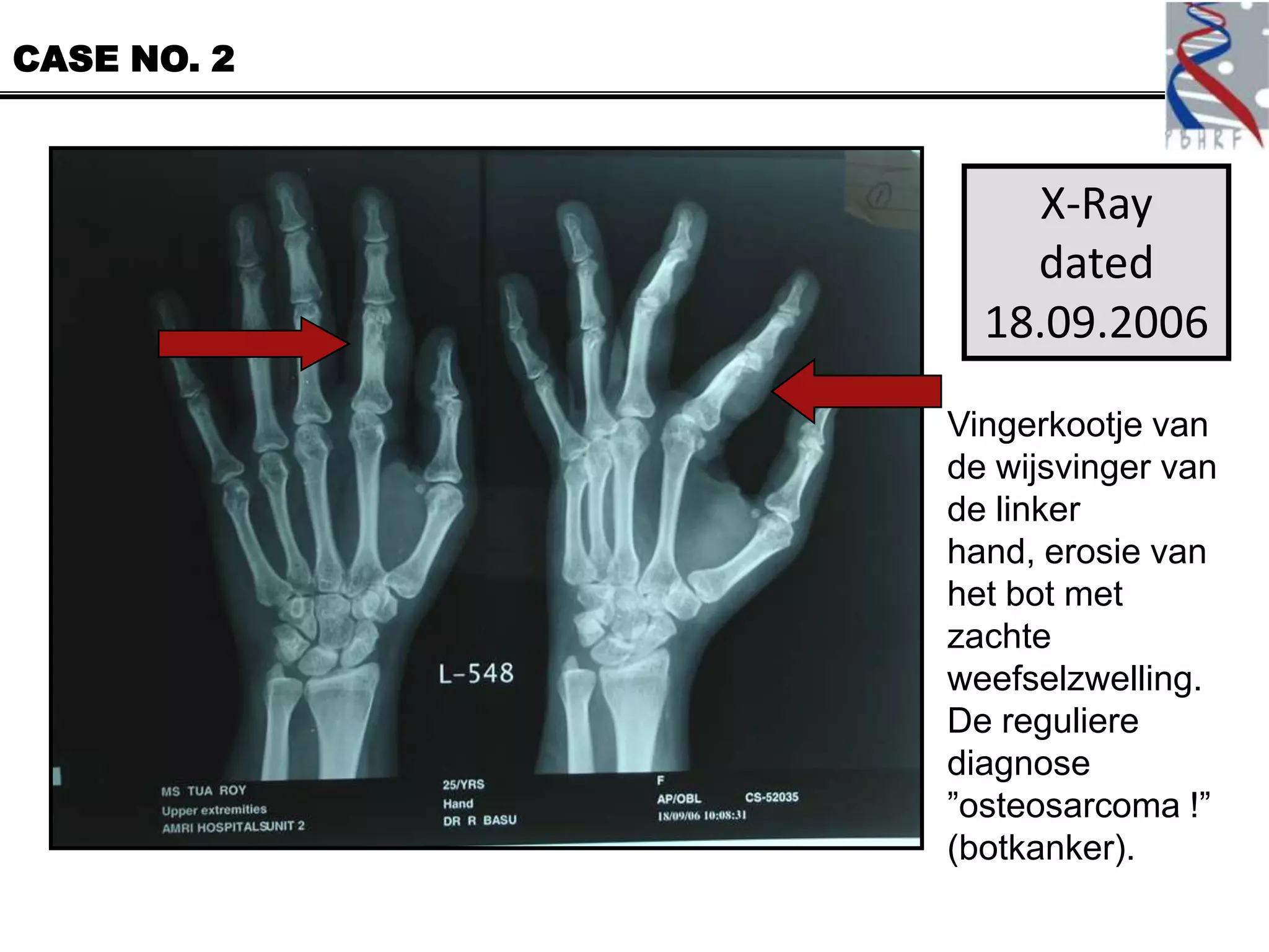 Banerji Protocols - Botkanker 1 | PPTX | Medical Health