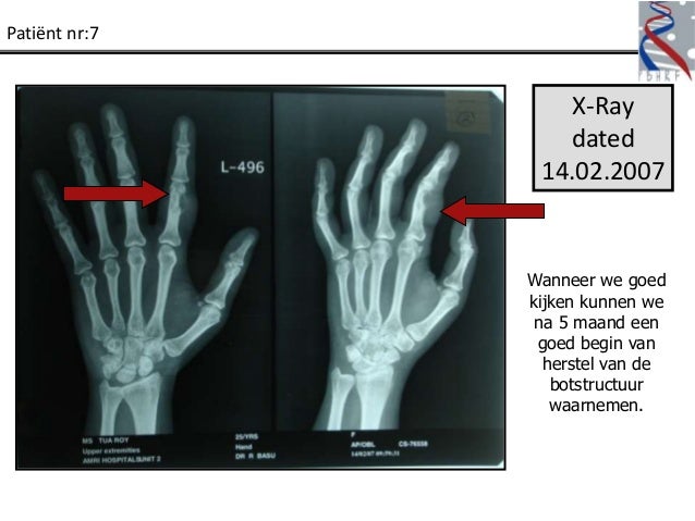 Banerji Protocols - Botkanker 1