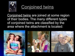 what are the twins and basic types? | PPT
