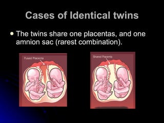 what are the twins and basic types? | PPT