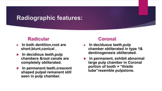 Dentin dysplasia | PPTX