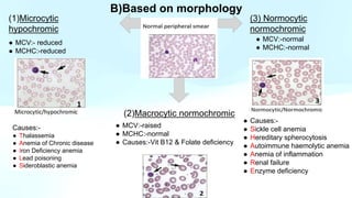 Anemia in pregnancy , definition , causes , pathogenesis, management ...