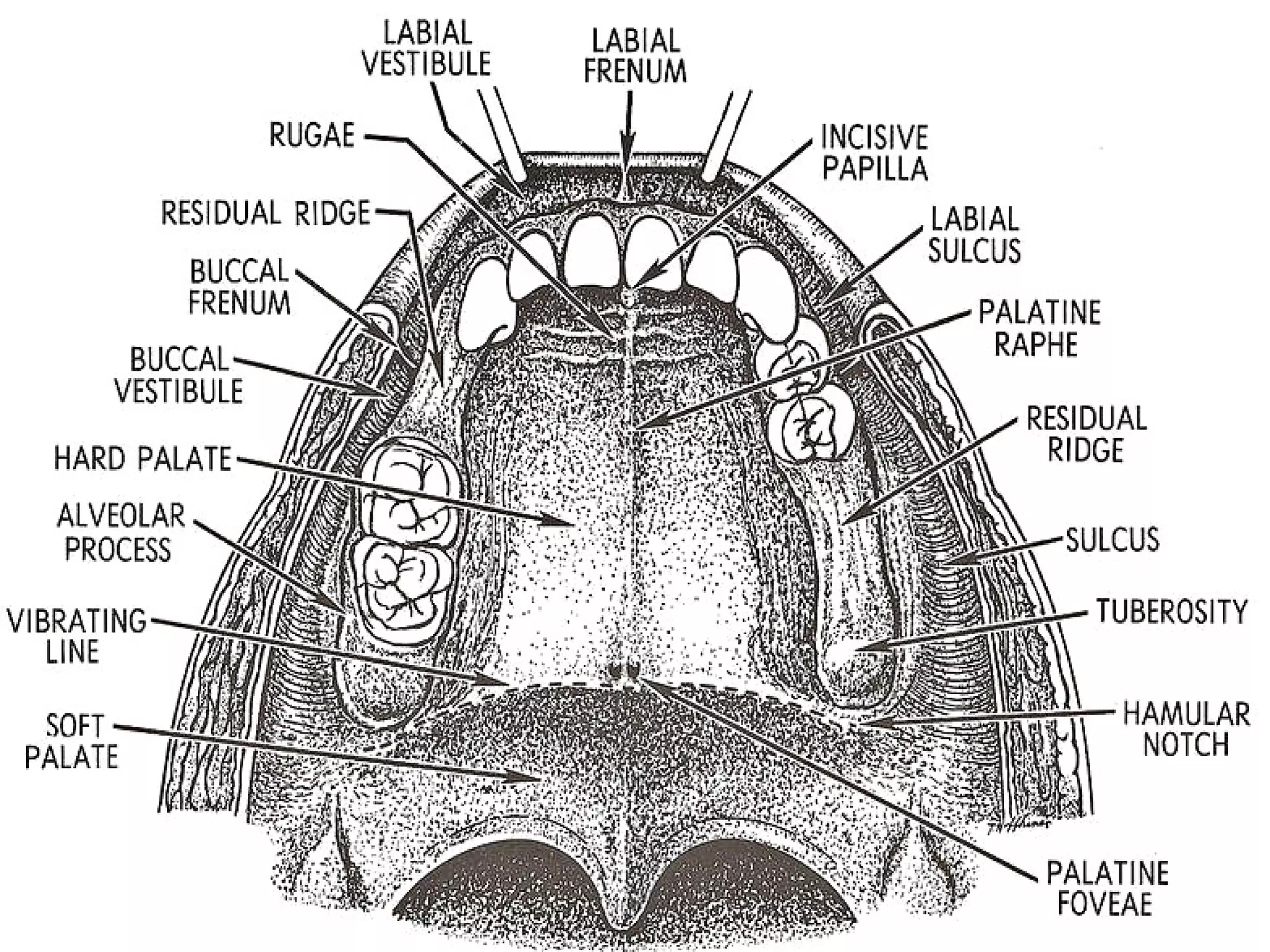 classification of soft palate and residual ridge | PPT